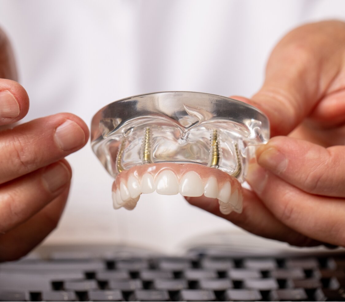 Dentist Stuart | Dr. Michael Sohl Implant & Cosmetic Dentistry